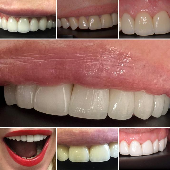 REKLĀMA: Durvis vērusi zobārstniecība ''ANROJA'' Ventspilī